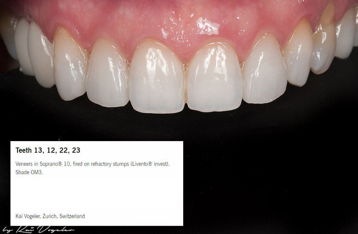 C&M Soprano®10 Gingiva - Veneering Ceramic for Lithium Disilicate and | Impulsedent Australia