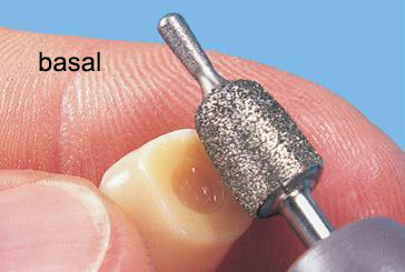 Bredent Diacryl Grinding Instrument Set-up grinding, 1 pc | Impulsedent ...