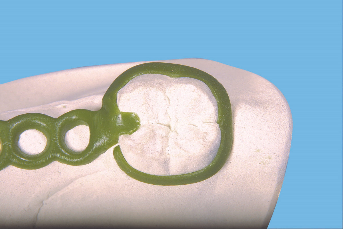 Bredent Protek circumferential clasp, 10 sheets of 20 clasp, bent ...