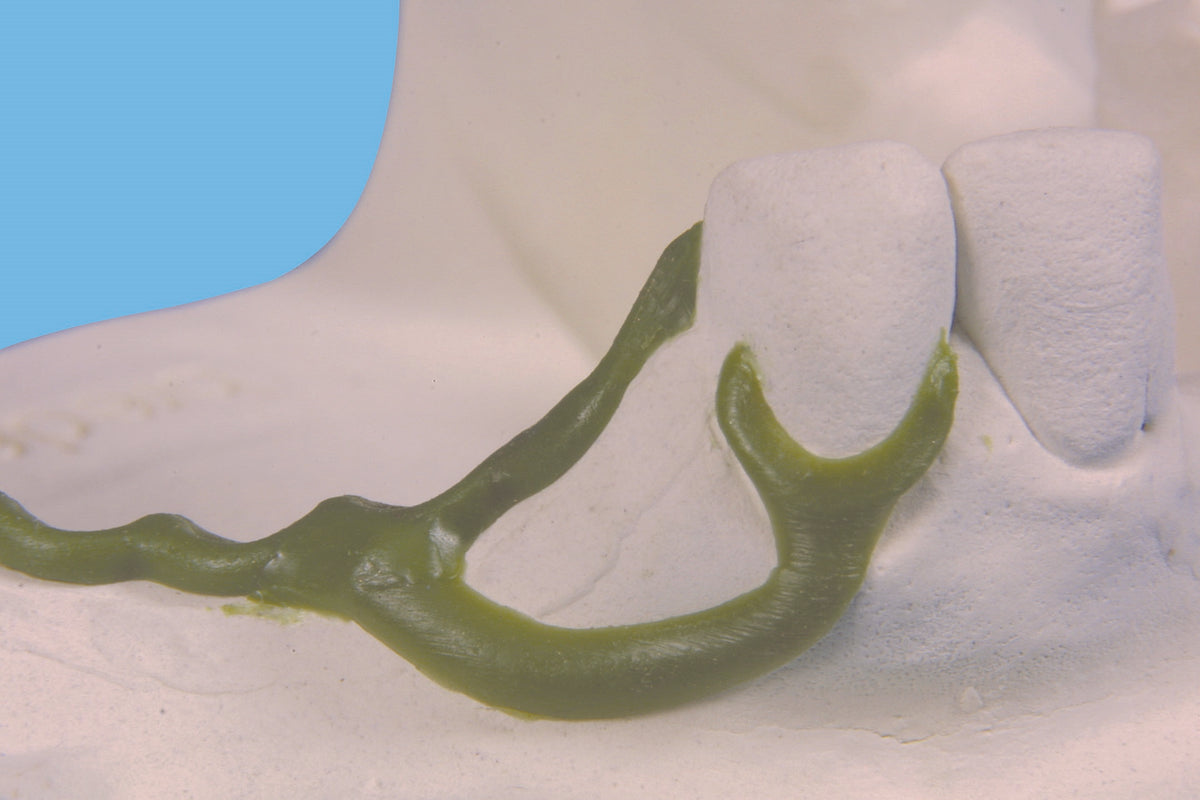 Bredent Protek bonyhard clasp, 10 sheets, 12 clasps each | Impulsedent ...