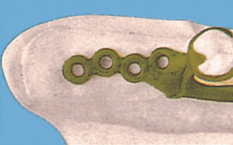 Bredent Protek perforated retainers staggered, 25 pcs, 13.5 cm long ...