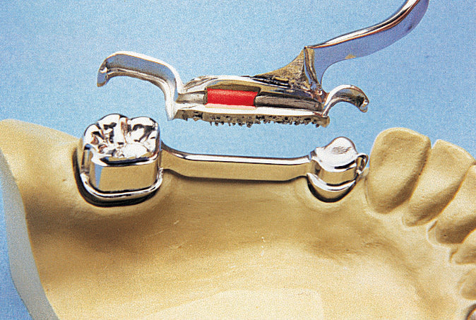 Bredent vario-soft-bar-pattern vsp-f matrices, 8 pcs | Impulsedent ...