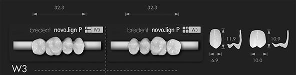 Bredent novo.lign Veneers Teeth – Upper posterior W3, Q1 right upper ...