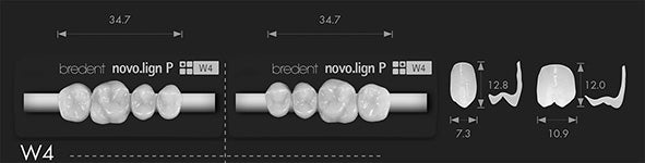 Bredent novo.lign Veneers Teeth – Upper posterior W4, Q1 right upper ...