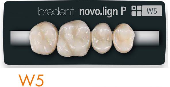 Bredent novo.lign Veneers Teeth – Upper posterior W5, Q1 right upper ...