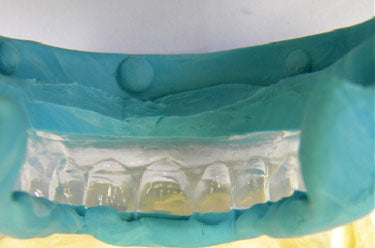 Bredent Visio.sil, 50ml | Impulsedent Australia