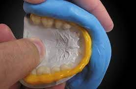 Bredent Visio.sil fix, 50ml | Impulsedent Australia